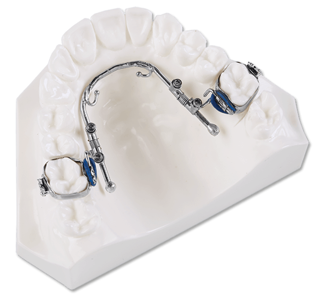 Distalizers - DynaFlex