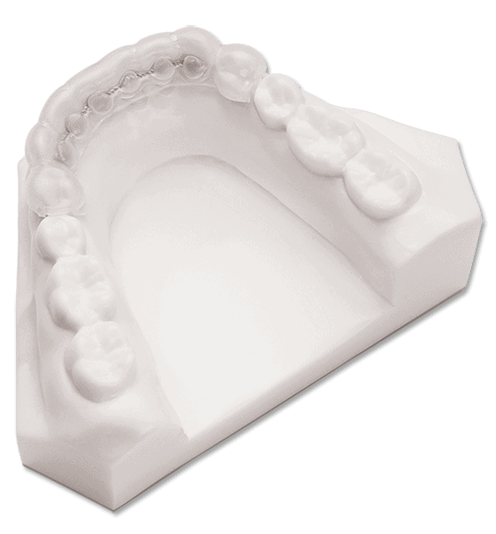 Fixed Retention - DynaFlex