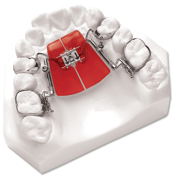 Distalizers - DynaFlex