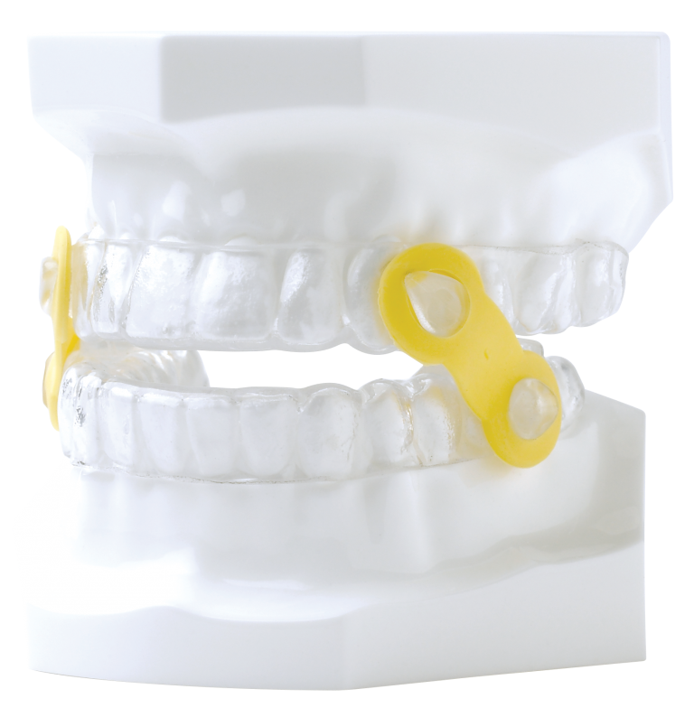 Elastic Mandibular Advancement (EMA) Appliance - DynaFlex
