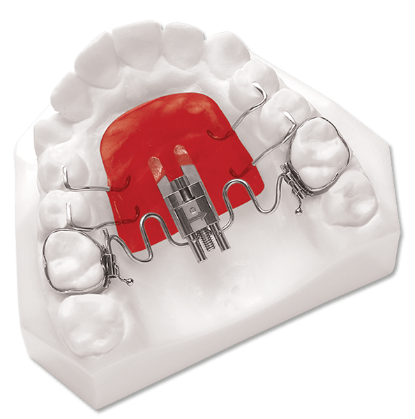 Distalizers - DynaFlex