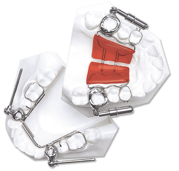 Herbst Orthodontic Appliance - DynaFlex