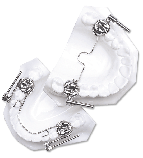 Orthodontic Appliance Herbst at Wayne Morgan blog