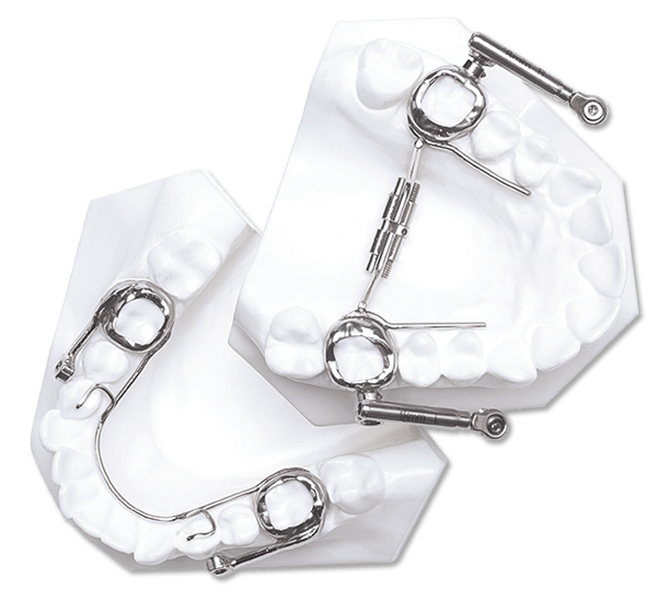Herbst Orthodontic Appliance - DynaFlex