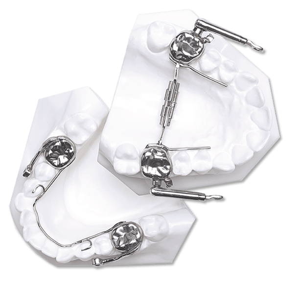 Herbst Orthodontic Appliance - DynaFlex