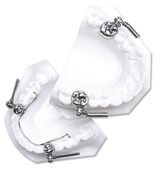 Herbst Orthodontic Appliance - DynaFlex