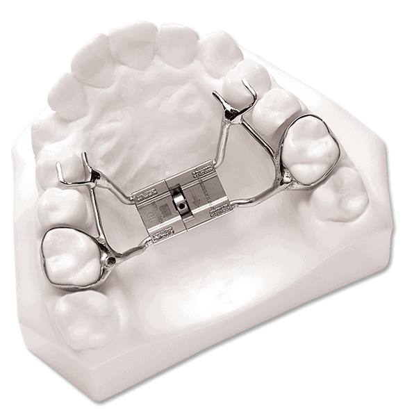 Fixed Expanders - DynaFlex