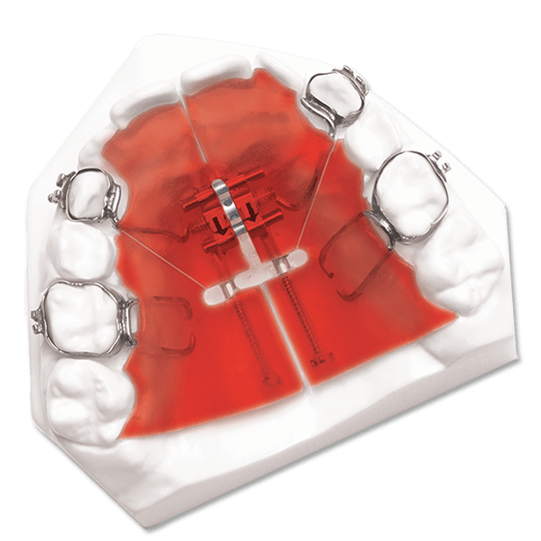 Series 2000 - DynaFlex