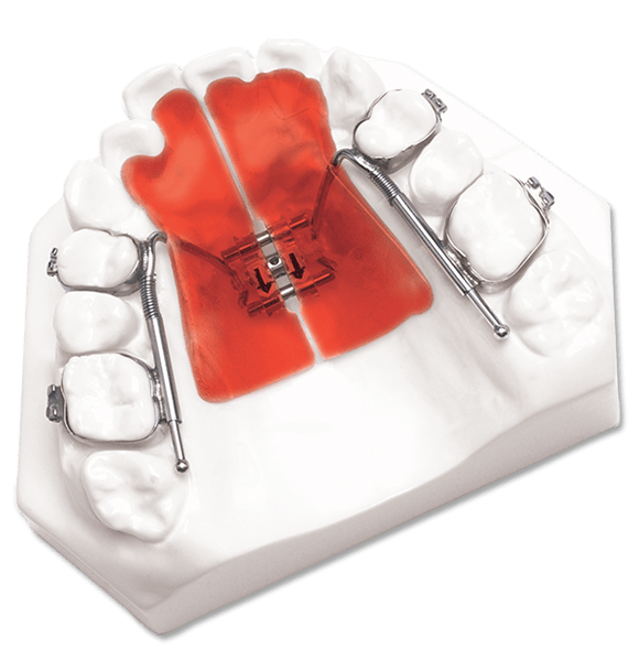 Series 2000 - DynaFlex