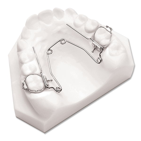 Fixed Orthodontic Appliances - DynaFlex