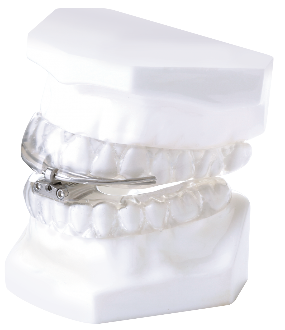 Thorton Adjustable Position (TAP) Devices - DynaFlex