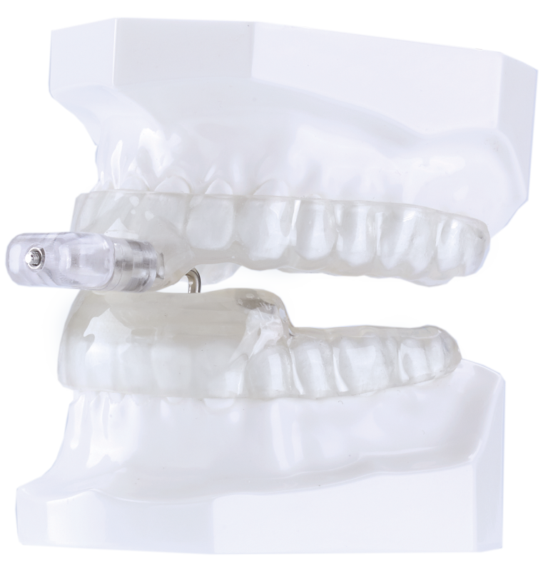Thorton Adjustable Position (TAP) Devices - DynaFlex
