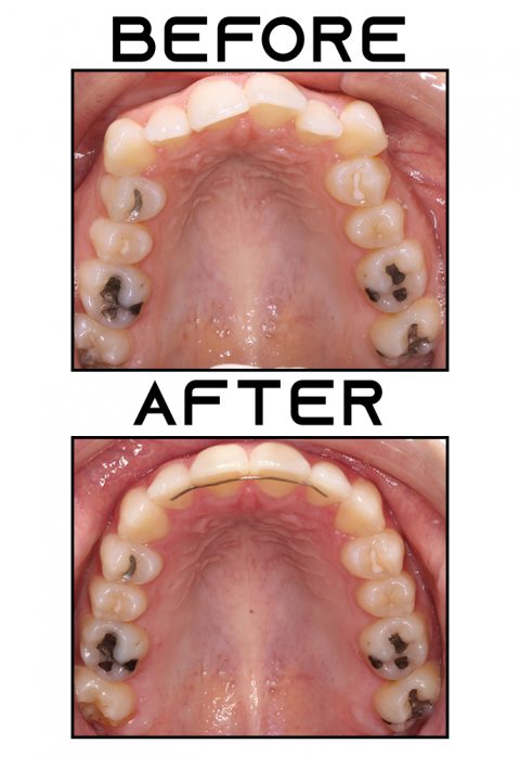 The Norris System - DynaFlex