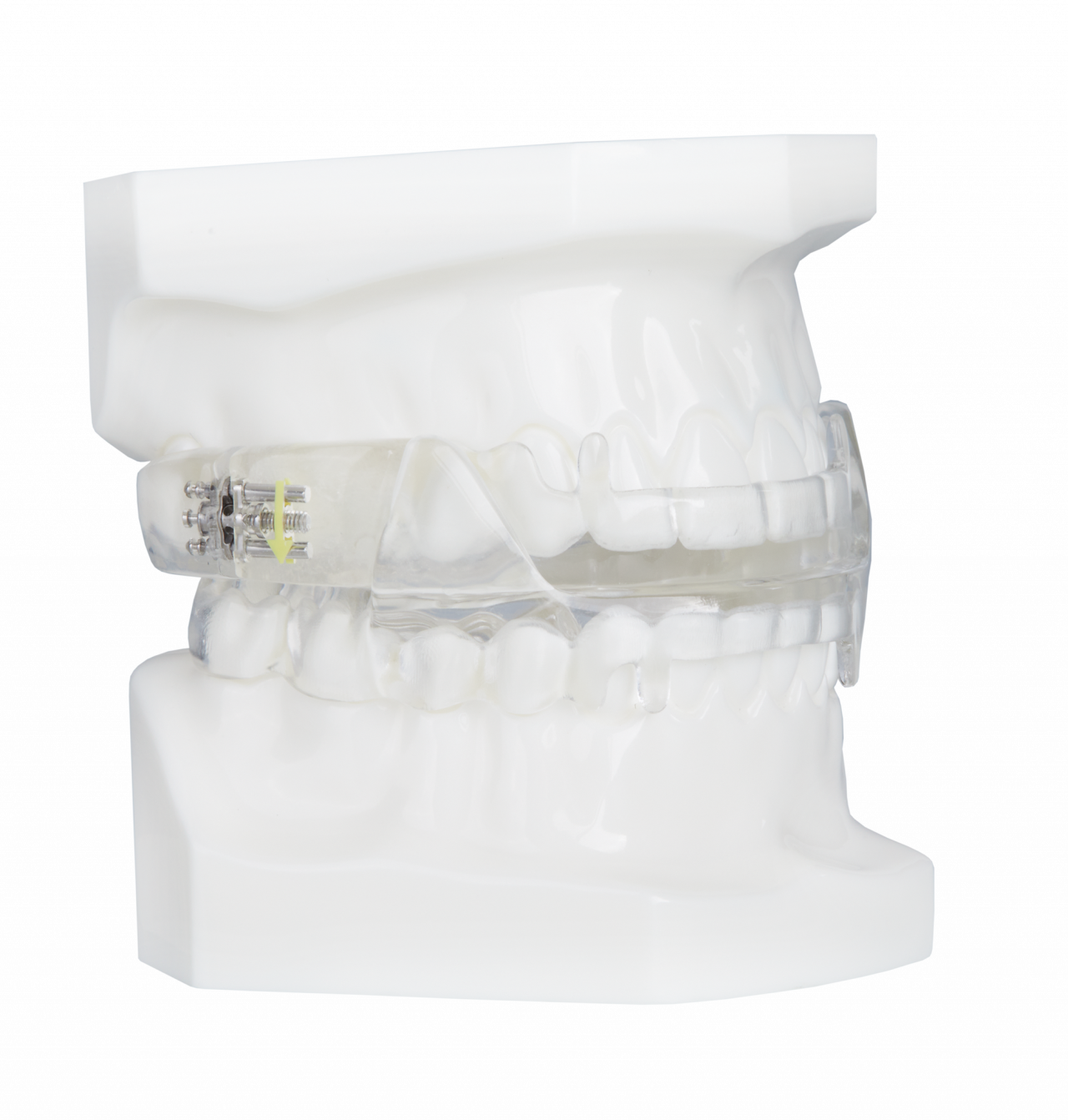 Dental Sleep Devices - DynaFlex Sleep Lab