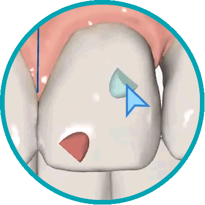 Smileshare - DynaFlex