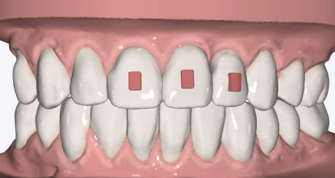 SmileShare - Systems - DynaFlex