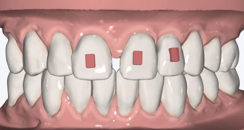 SmileShare - Systems - DynaFlex