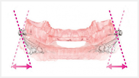 Respire Pink AT (Advanced Titration) - DynaFlex