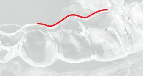 Ortho Retainers - DynaFlex