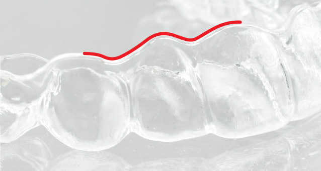 Ortho Retainers - DynaFlex