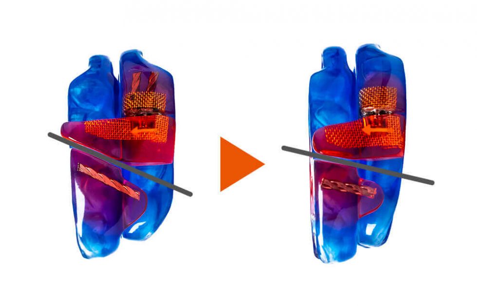 Respire Blue+ Design - DynaFlex