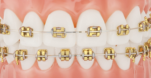 Atlas Mini Bracket System - DynaFlex