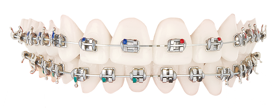 Atlas Mini Bracket System - DynaFlex